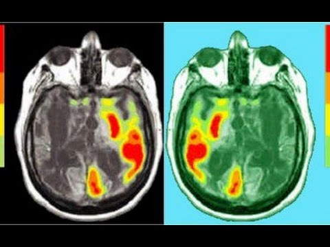 Ready for this? Two Minds in One Brain - The Mind Voyager