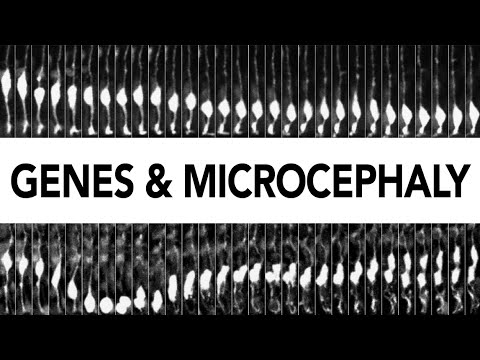 How Genetic Defects Cause Microcephaly - The Mind Voyager