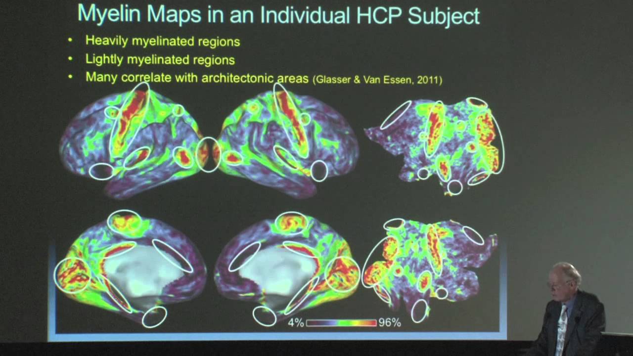 The Human Connectome Project: Progress & Prospects (October 2014) - The ...